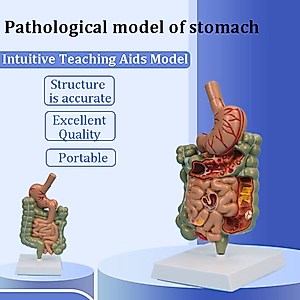 PAASHE Anatomy Model Human Stomach Anatomy Model Organs Model Human Body Model Stomach Section Large Small Intestine Medical Model Study Education
