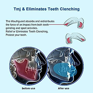 Kids Mouth Guard for Teeth Grinding, Pack of 4 Bite Guards + Dental Guard Case, Eliminate Clenching Bruxism, Teeth Whitening Tray & Sports, Child Moldable Bite Guards(5-10 Years Old Kids)