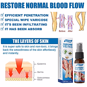 OUKPANE 2pcs Veinhealing Varicose Veins Treatment Spray, Veinhealing Varicose Veins Spray, Vein Healing Varicose Veins Treatment Spray for Legs, Varicose Veins Miracle Spray (30ml)