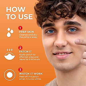 PatchRx Acne Patches (120 Count) with Hydrocolloid Only, Hydrocolloid Pimple Patches for Face - Zit Patch Acne Dots - Acne Patches - Pimple Patch with 3 Size Acne Stickers