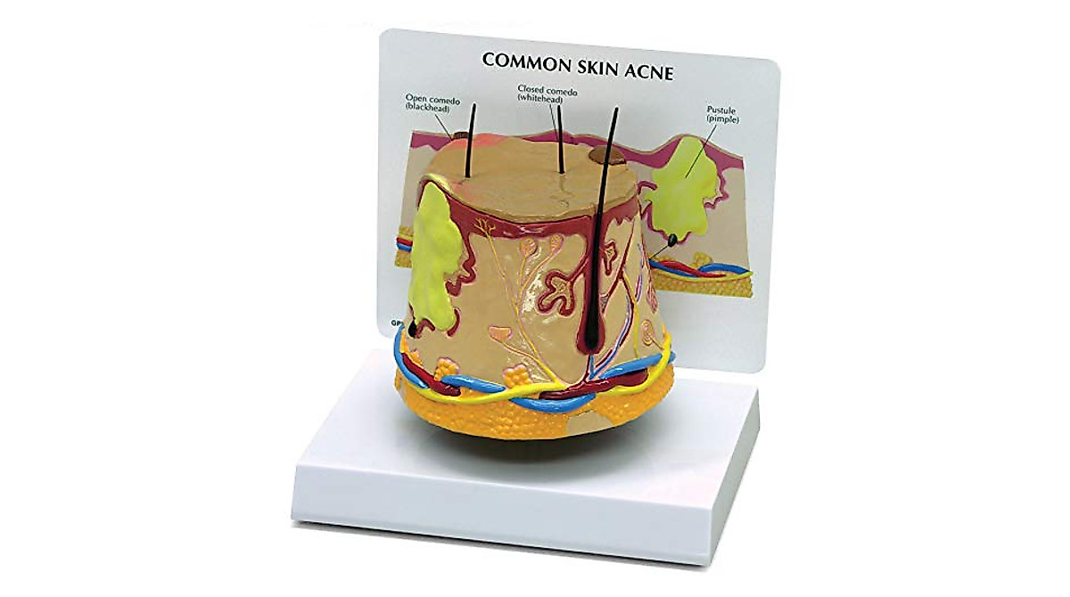 GPI Anatomicals Skin Acne Model for Education