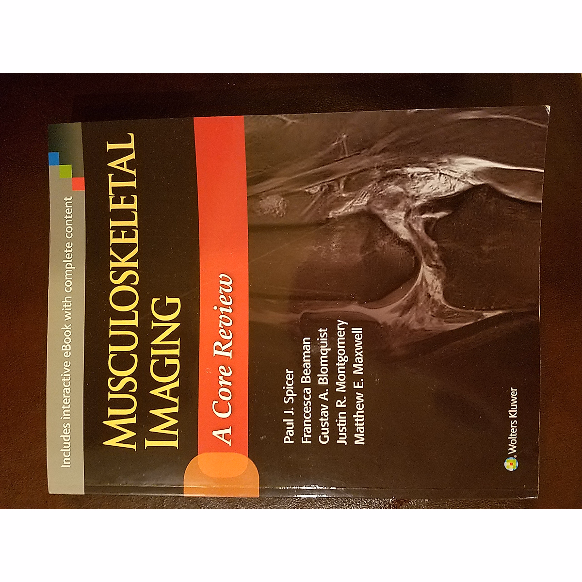 Musculoskeletal Imaging: A Core Review