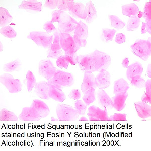 Eosin Y Solution (Modified Alcoholic), 1 Gallon