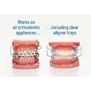 OrthoDots CLEAR – Moisture Activated Braces Wax Alternative for Pain Caused by Braces, Clear Aligner Trays, and Other Orthodontic Appliances. OrthoDots Stick Better and Stay on Longer than Dental Wax.