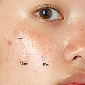 Epielle Over-Zit Acne Variety Patches | 84 Hydrocolloid Acne Pimple Patch for Covering Zits and Blemishes for Full Face (84 Counts), Easter Gift