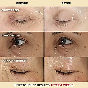 IT Cosmetics Confidence in an Eye Cream, Anti Aging Eye Cream for Dark Circles, Crow's Feet, Lack of Firmness & Dryness, 48HR Hydration with 2% Super Peptide Concentrate, for Day + Night - 0.5 fl oz