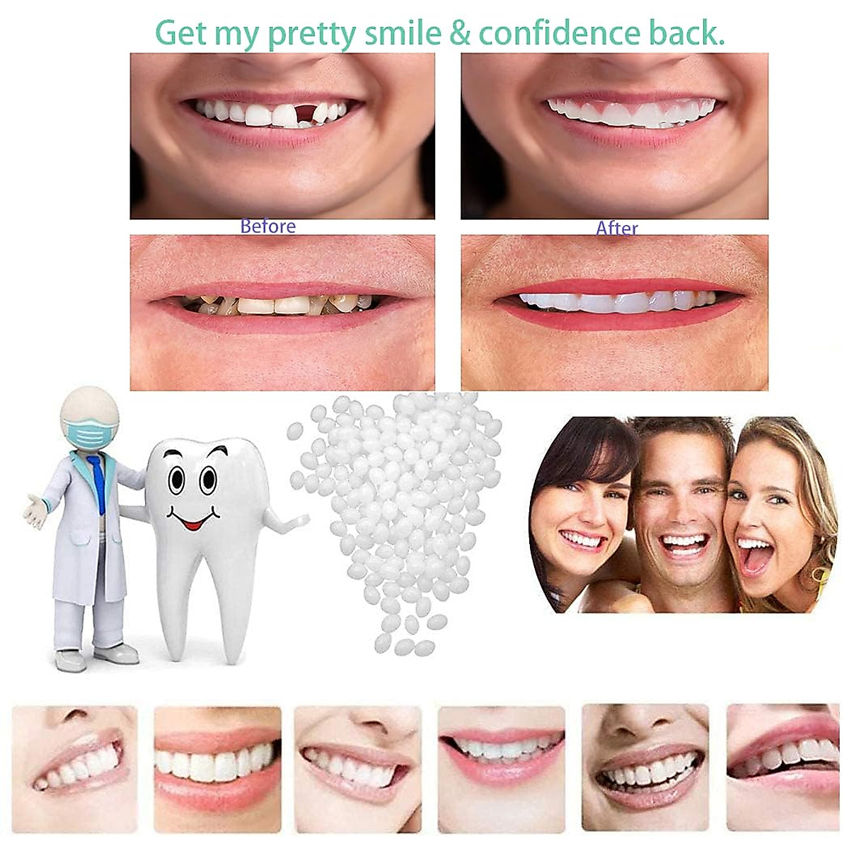 Fake Teeth,Daily Tooth Repair Kit,False Teeth For Veneers Teeth Men Beads Braces Cover Imperfect Teeth,Denture Repair Kit Cover Missing Teeth Snapon Smile,Veneers Teeth For Women Men Dental Repair Kit