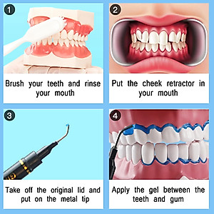 Dental Gingival Barrier Protection Gel, 10PCS 3ML Gum Protector Gel for Teeth Whitening