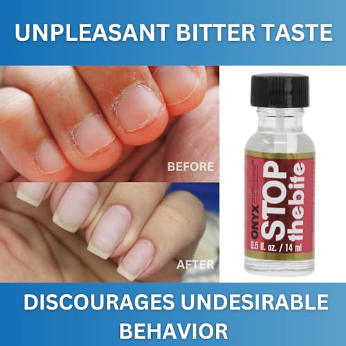 Onyx Professional Stop the Bite Nail Biting Deterrent Polish 0.5 Fl Oz - Helps Nails Grow & Can be Used as a Top or Base Coat