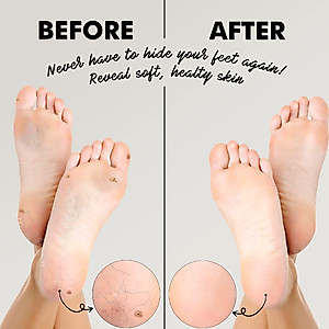 Jairestone Pumice Stone for Feet - Natural Earth Lava Pumice Stone for Foot Callus - Foot Scrubbers for Use in Shower - Pack of 2