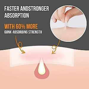 AUSLKA Large Blemish Zit Patches XL - 20 Strips - Hydrocolloid Dots -Blemishes Patch - Zit Breakouts - Blemishes Stickers - Max Size