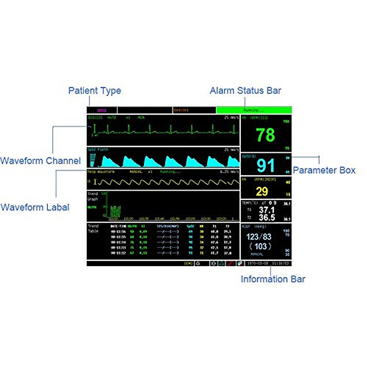 PM6000VP 12" Veterinary Multi-Parameter Monitor with ECG RESP SpO2 NIBP Temp PR Printer