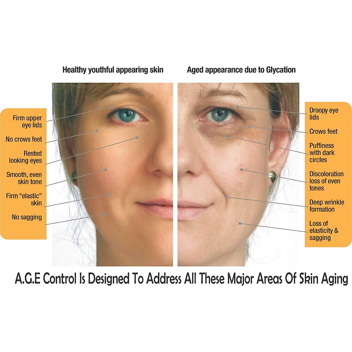 AGE Control Dual Treatment Anti Glycation Serum: Look 8-10 Years Younger In 60 Days. Reduce Discoloration & Dark Spots, Lifting, Firming, Brightening, Hydrating, Anti-Wrinkle, Non Greasy