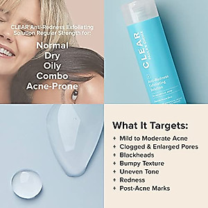 Paula's Choice CLEAR Regular Strength Exfoliator, 2% Salicylic Acid Exfoliant for Acne, Redness Relief, 4 Ounce