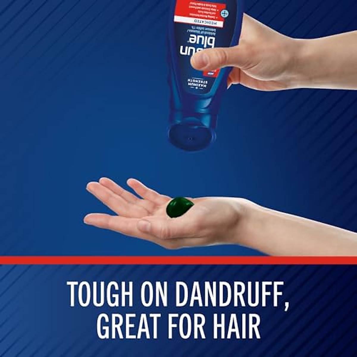 Selsun Blue Medicated Antidandruff Shampoo, Maximum Strength Scalp Treatment With Selenium Sulfide, 11 fl. oz.