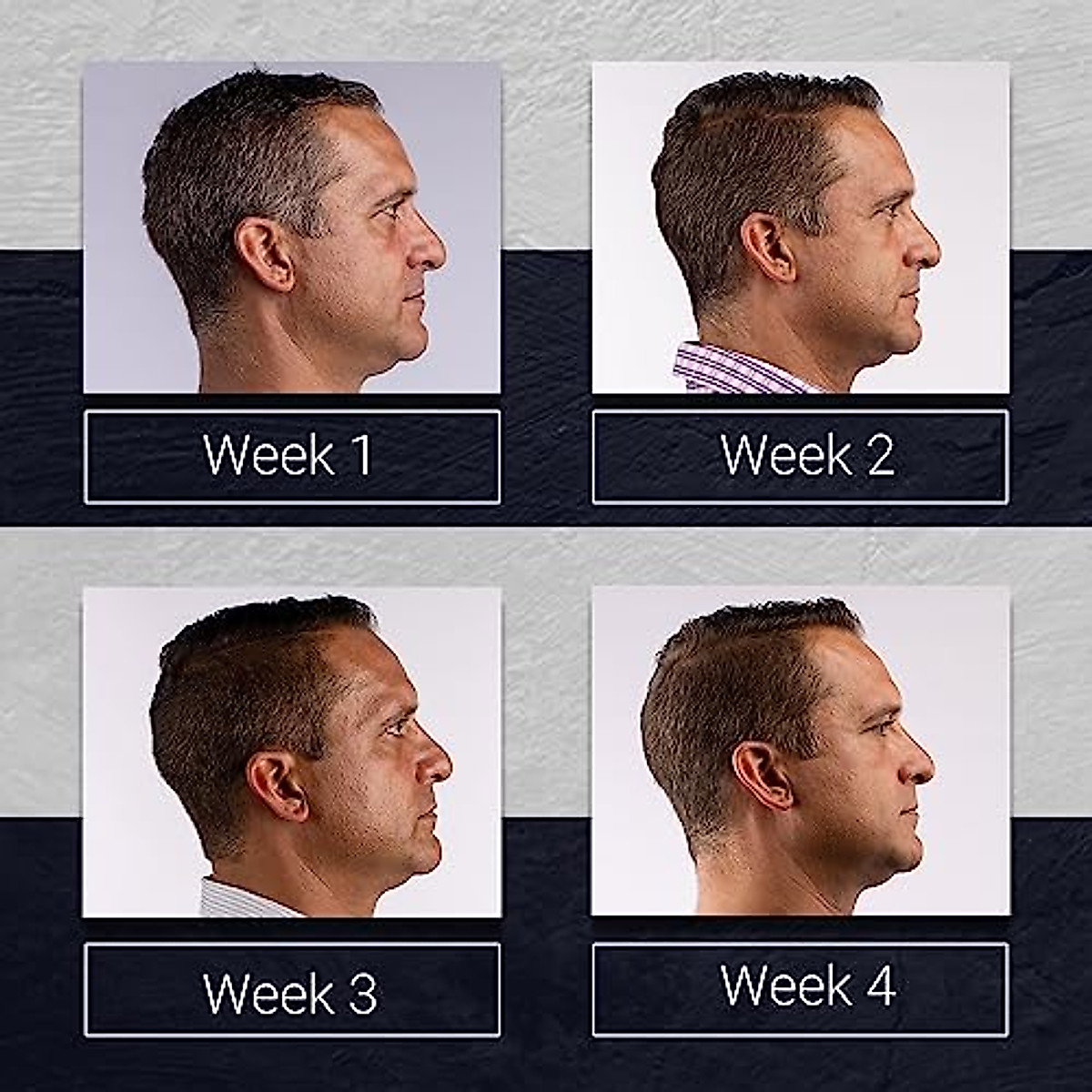 Youthair Crème, Color Restoring Conditioning, Formula, 3.75 Ounces