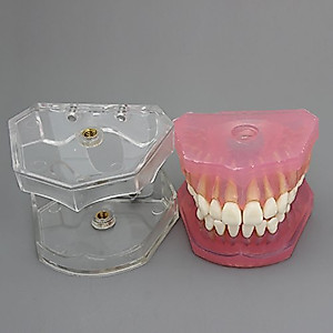Dental Implant Teeth Model Study Teach Standard Model with Removable Teeth
