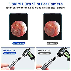 Cainda Otoscope USB Ear Camera, Ear Wax Removal Endoscope with Light for Android Phone Window and Mac PC (Not for iPhone), Digital USB Camera with Ear Cleaning Earwax Removal Tool