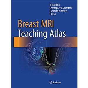 Breast MRI Teaching Atlas