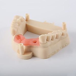 RESIONE 3D Printer Resin, D01S Dental Model Resin for Restoration Implant Study Models High Dimensional Accuracy with Not Warped and Very Low Shrinkage for LCD DLP MSLA 3D Printing