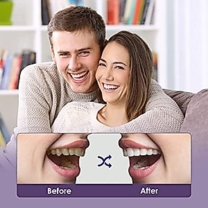 Fake Teeth Kit, 4 PCS Dentures Teeth for Women and Men, Dental Veneers for Temporary Teeth Restoration, Nature and Comfortable, Protect Your Teeth and Regain Confident Smile