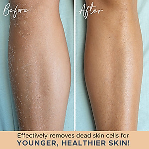 Exfoliating Glove (4 Pcs, 2 Pairs) - Medium Exfoliate Glove for Dead Skin Bath Exfoliating Gloves for Shower Spa Massage Body Scrub - Shower Gloves Exfoliating for Women & Men