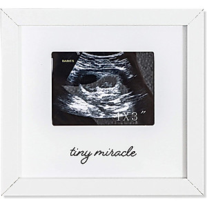 Juvale White Sonogram Keepsake Frame for 4 x 3 Ultrasound Photos (7 x 6.5 Inches)