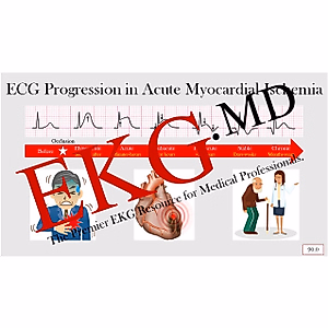 Ultimate EKG Breakdown - The EKG Guy