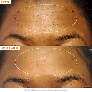 Kinship Brightwave 10% Vitamin C + Peptide Serum - Fade Dark Spots, Reduce Fine Lines & Wrinkles - Brighten, Plump & Smooth Face - Vegan Collagen - Anti-Aging Skincare - All Skin Types (1 Fl Oz)