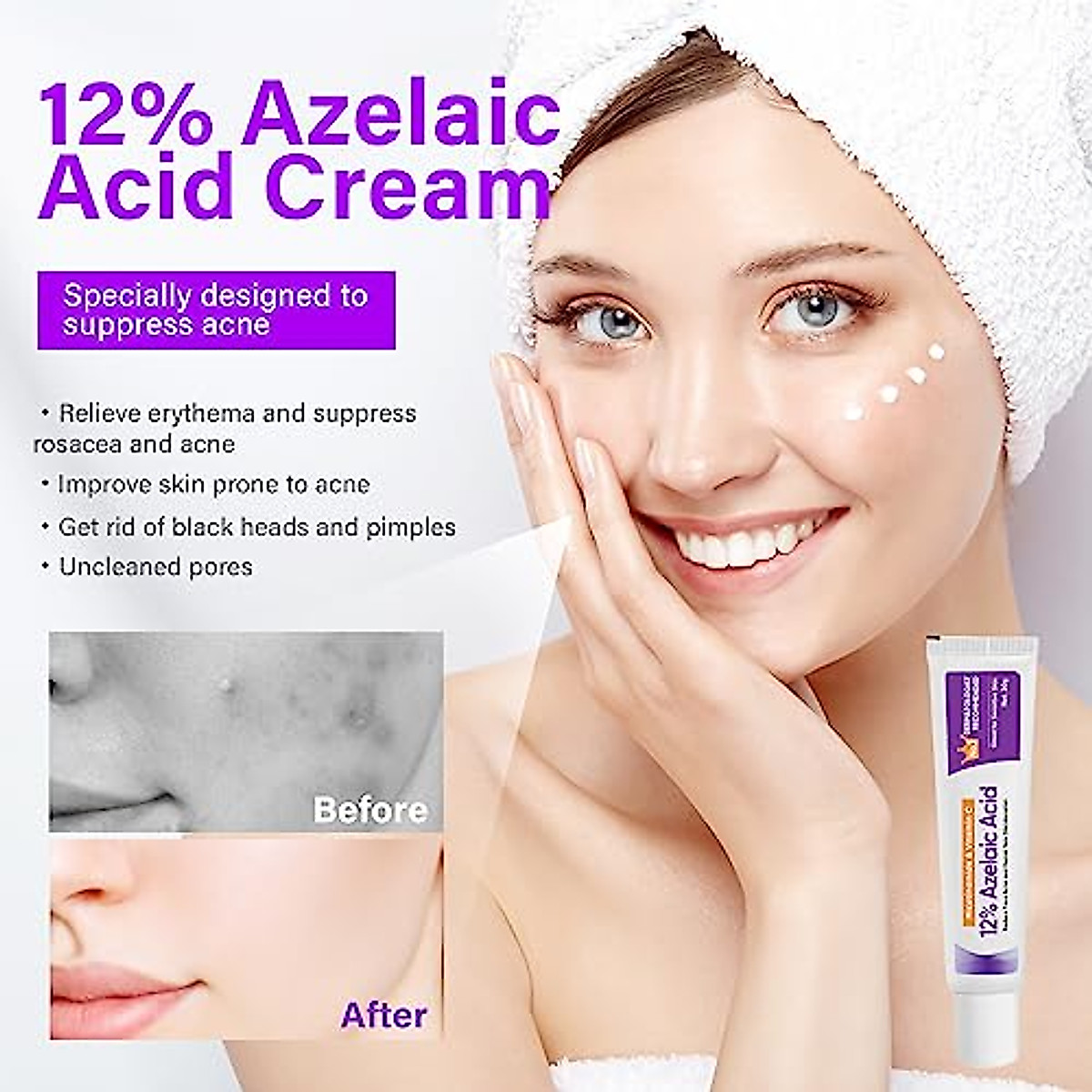 Azelaic Acid 12% Facial Serum,Skin Brightening Hyaluronic Acid and Niacinamide, Redness Relief, Fade and Repair Dark Spots