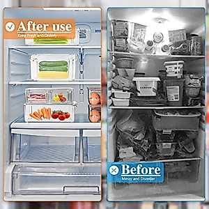 Modern-Depo 7 PCS Refrigerator Organizer Bins with Lids Food Containers with Various Size Stackable Storage Bins for Fridge, Countertop, Cabinets & Pantry