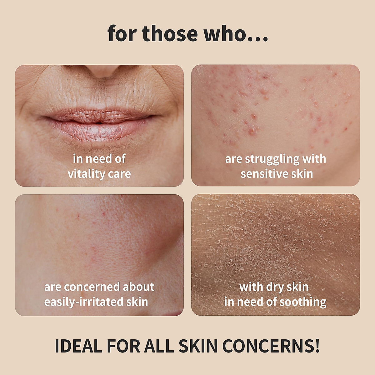 BENTON Snail Bee High Content Skin (Toner) - Snail Secretion Filtrate & Bee Venom - Moisturizing & Soothing Toner for Oily, Acne-Prone Skin - Dermatologically Tested, 5.07 fl. oz.