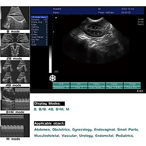 JZRYL Portable Vet/Veterinary B-Ultrasound Scanner with 3.5Mhz Convex Probe for Horse,Goat,Cow,Sheep and Pig use (3.5 MHz Convex Probe)