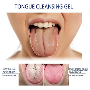 Tongue Cleaning Gel Set, Tongue Cleaner Gel with Tongue Brush, Tongue Scraper Scrubber for Adults with Cleaning Gel, Easy to Use for Men Women