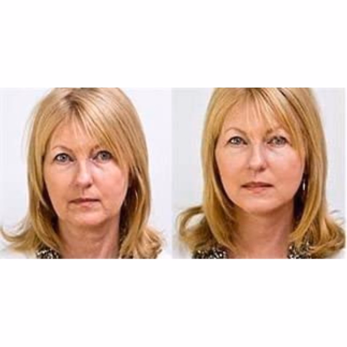 ART HARDING'S Instant Face and Neck Lift (Dark)