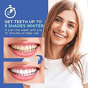 LUELLI Teeth Whitening Kit with LED Light, 35% Carbamide Peroxide, Teeth Whitening Gel, Helps to Remove Stains from Coffee, Smoking, Wines, Soda, Food, Home Dental Products for Sensitive Teeth