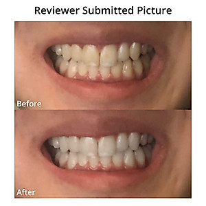 Taeity Teeth Whitening Strips - Non-Sensitive & Strong Formula (28 Strips, 14 Treatments)