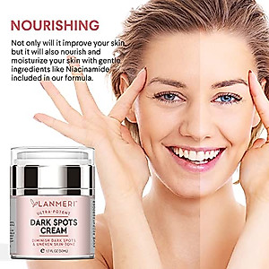 Lanmeri Dark Spot Remover for Face and Body, Dark Spot Corrector Fade Cream, Age Spot, Brown Spot, Sun Spot & Freckle Remover for Face, Hands and Other Body Areas, for Both Women and Men, for All Skin Types