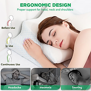 Iwacool Cooling Cervical Pillow for Neck Pain Relief and Memory Foam Pillows