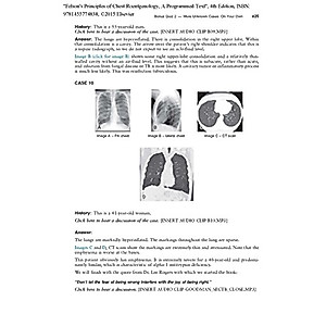 Felson's Principles of Chest Roentgenology, A Programmed Text (Goodman, Felson's Principles of Chest Roentgenology)