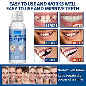 Tooth Repair Kit, Tooth Repair Granules, Nano-Molecule Teeth Filler Glue, Temporary Tooth Filling Kit for Temporary Restoration of Missing & Broken Teeth (2PC)