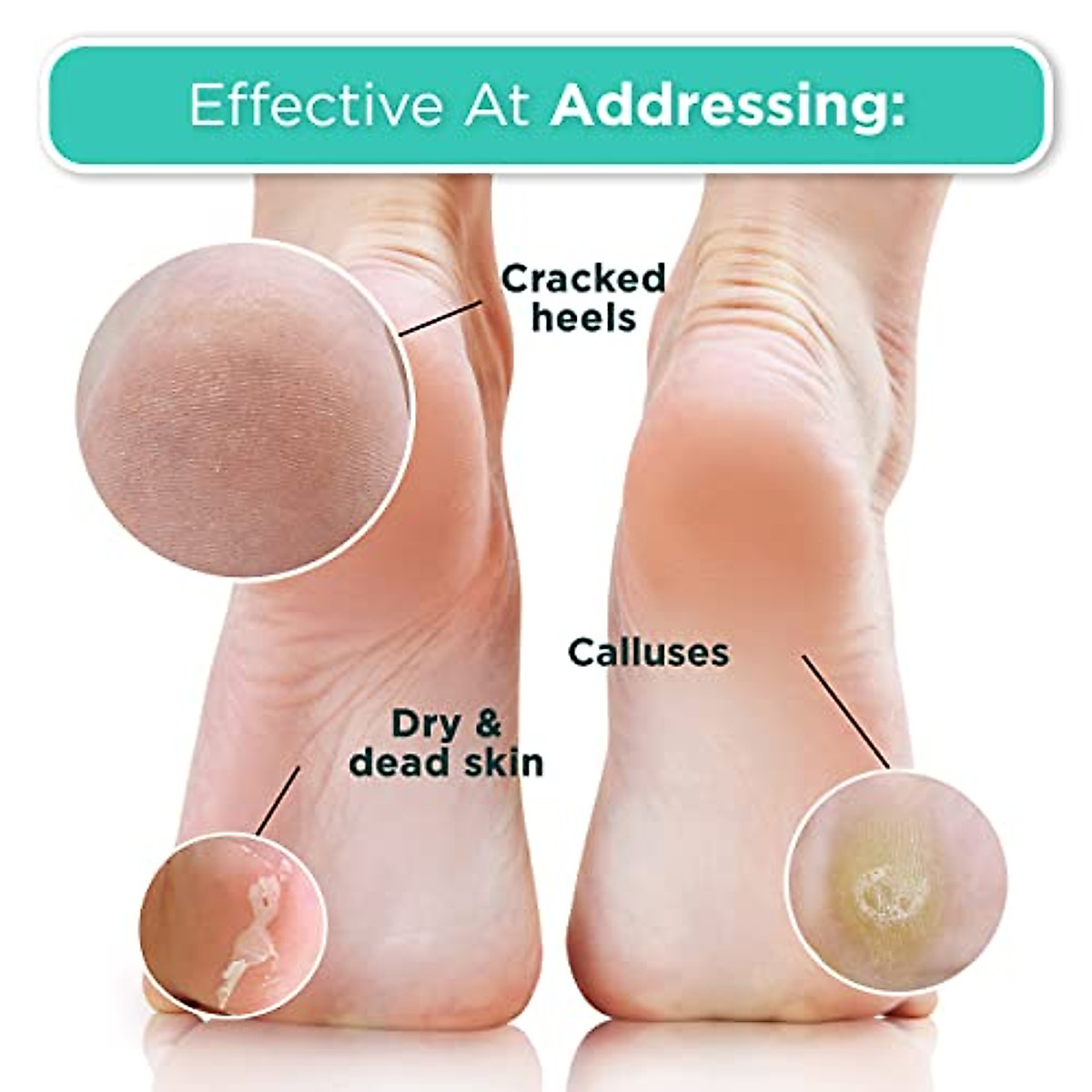 DERMORA Foot Peel Mask - 2 Pack of Regular Size Skin Exfoliating Foot Masks for Dry, Cracked Feet, Callus, Dead Skin Remover - Feet Peeling Mask for baby soft feet, Original Scent