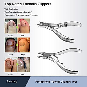 Podiatrist Nail Clippers, Professional Thick & Ingrown Toenail Clippers for Men & Seniors,Pedicure Clippers Toenail Cutters, Super Sharp Curved Blade Grooming Tool