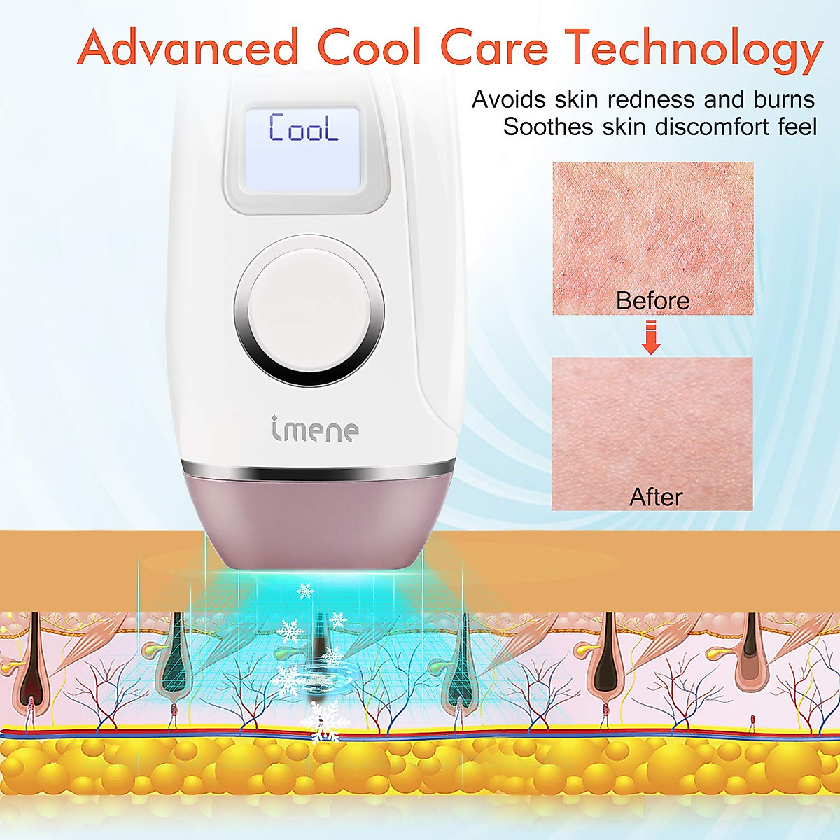 IMENE Permanent Hair Removal Machine for Women & Men, 500,000 Flashes IPL Hair Removal System with Ice Care Function for Full Body Home Use Hair Removal-Safest and Fastest IPL Technology