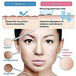 Toyo - Cure Aqua Gel Gentle Exfoliator - Facial/Full-body Peeling Gel, Water-based Exfoliator, Dead Skin Remover for Bright, Youthful Skin, 250ml. - 1 Pack