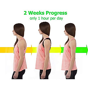 Rayovac UltraPRO Alkaline D Batteries, ALD-12