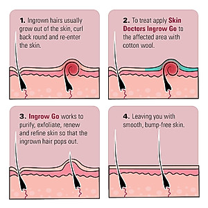 Skin Doctors Depilatories Ingrow Go 120 Ml : 1 Piece