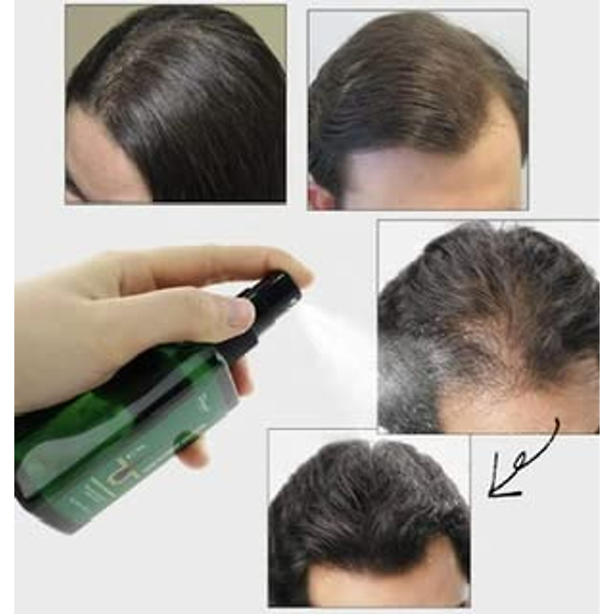 Anti-Hair Loss Spray Hair Nutrient Solution, 120 ml