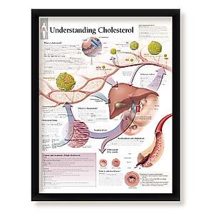 Set of 4 Framed Medical Posters Understanding Diabetes Understanding Cholesterol Understanding Metabolic Syndrome and Understanding Hepatitis 22"x28" Wall Diagrams
