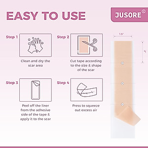 Silicone Scar Tape Scar Sheets - Professional Medical Grade Scar Removal Treatment, Non irritating, Painless for C-Section, Surgical Scars, Burn, Keloid, Acne(1.6” x 60” Roll)